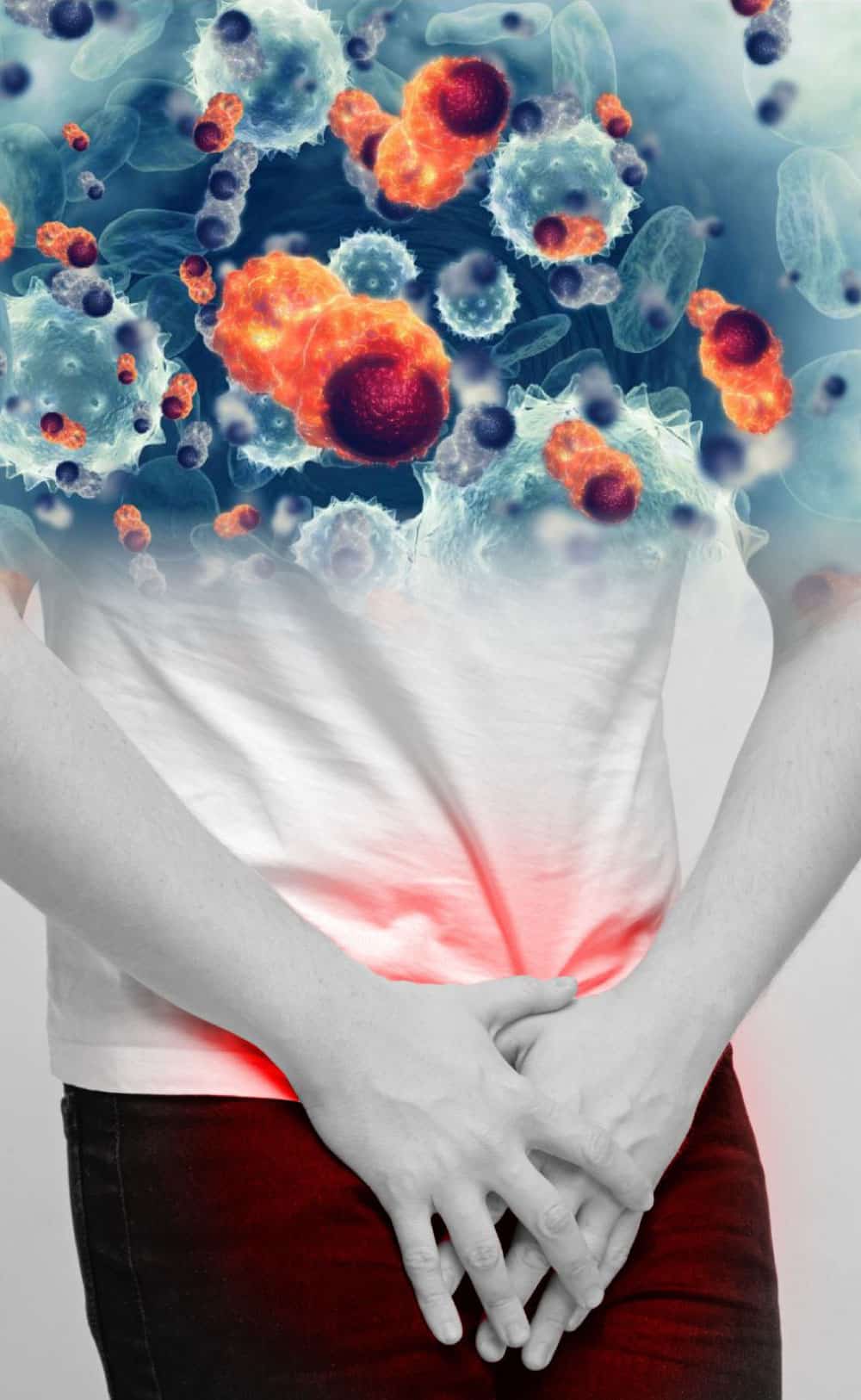 Prostate Cancer Stem Cell Research - The Beljanski Foundation